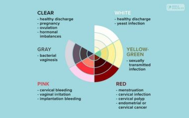 Vaginal Discharge Color Changes: What's Normal And What's Not!