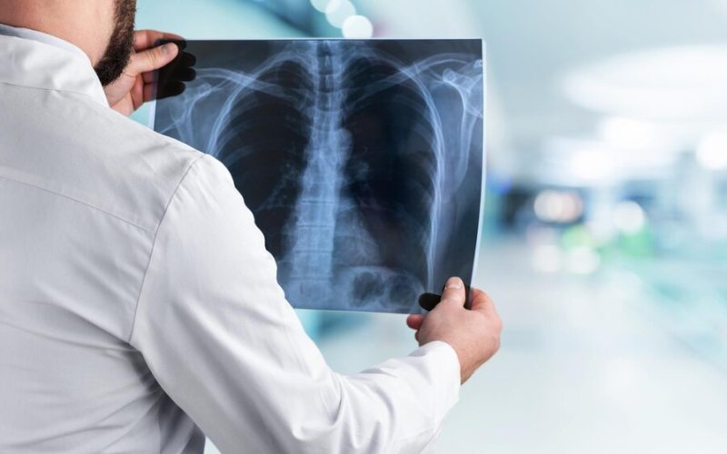 Coal Board Medicals: Everything You Need To Know